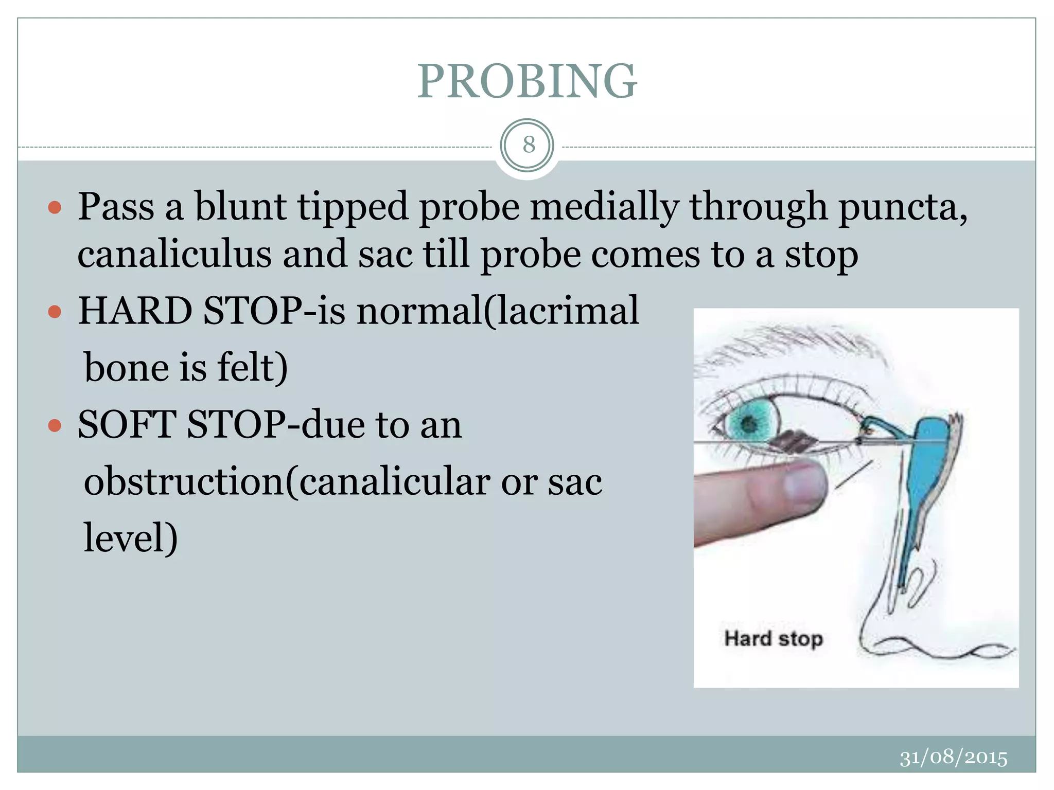 Tests done to assess patency of lacrimal drainage | PPTX