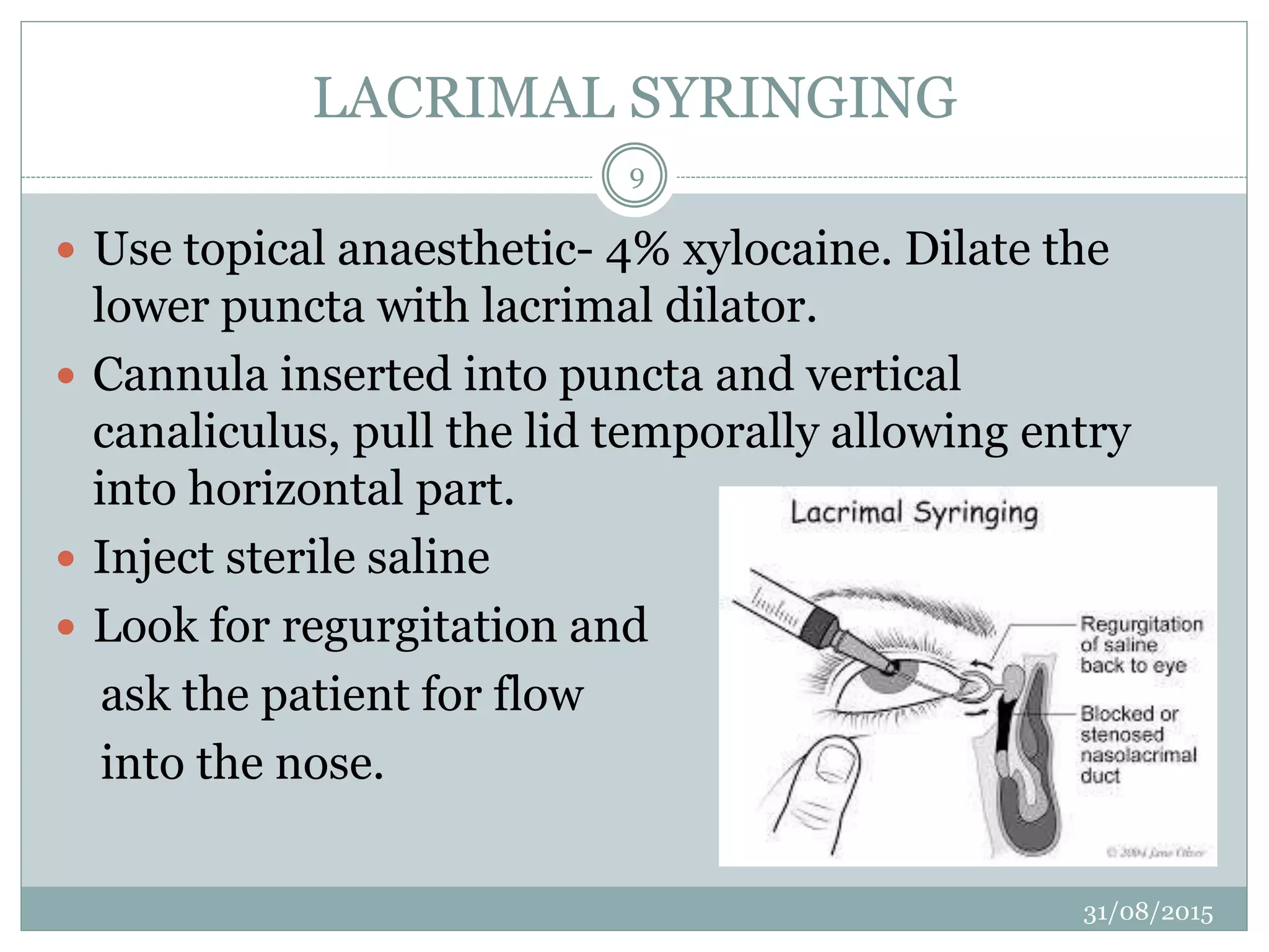 Tests done to assess patency of lacrimal drainage | PPTX