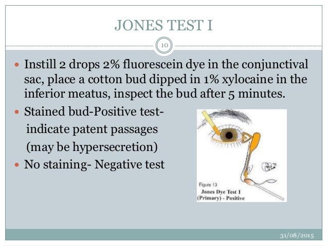 Tests done to assess patency of lacrimal drainage