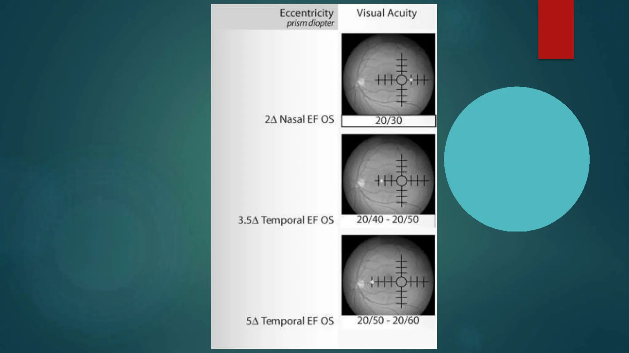 TESTS FOR GRADE OF BINOCULAR VISION AND SENSORY.pptx
