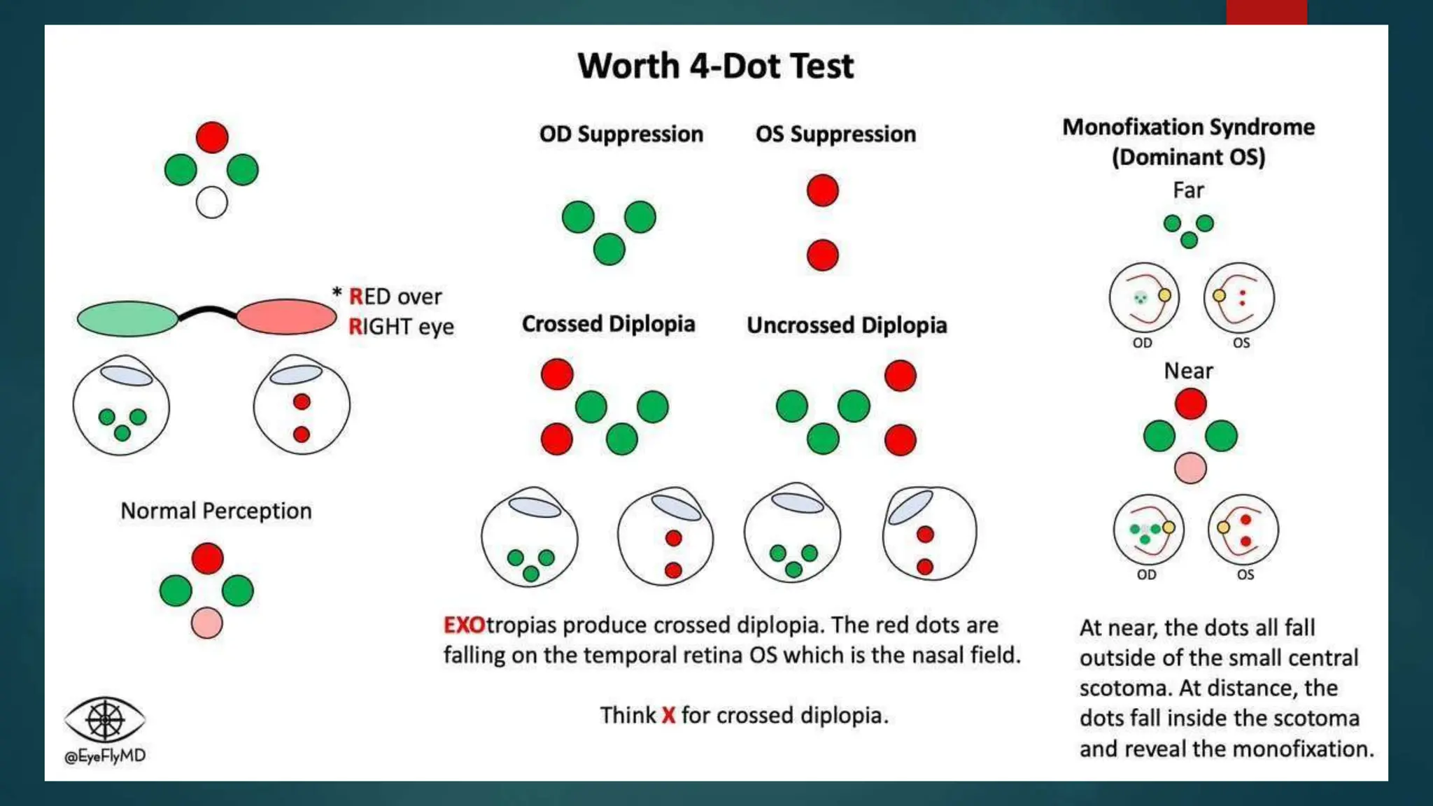 TESTS FOR GRADE OF BINOCULAR VISION AND SENSORY.pptx