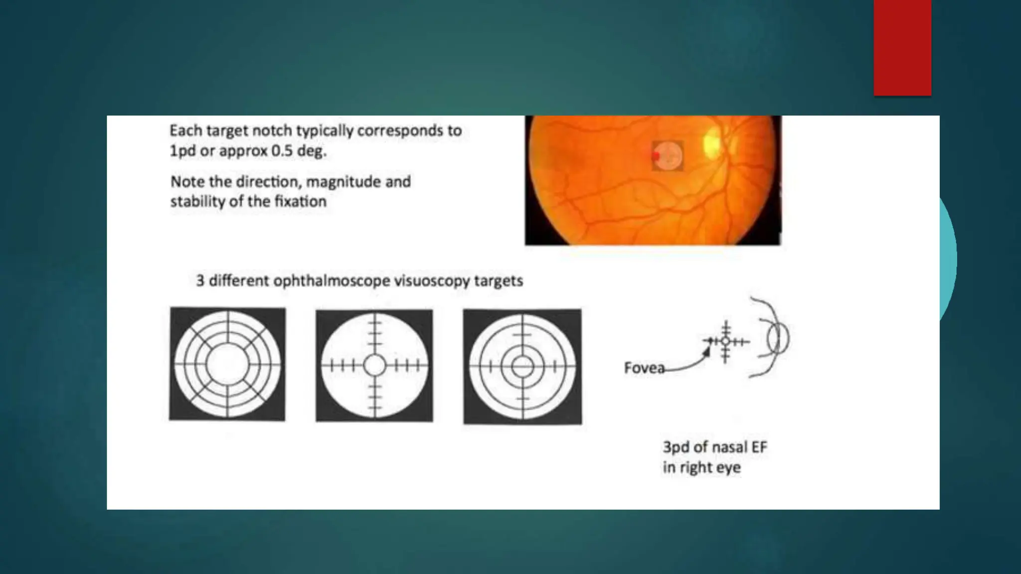 TESTS FOR GRADE OF BINOCULAR VISION AND SENSORY.pptx