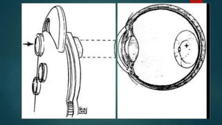 TESTS FOR GRADE OF BINOCULAR VISION AND SENSORY.pptx