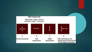 TESTS FOR GRADE OF BINOCULAR VISION AND SENSORY.pptx