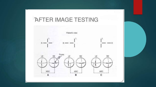 TESTS FOR GRADE OF BINOCULAR VISION AND SENSORY.pptx