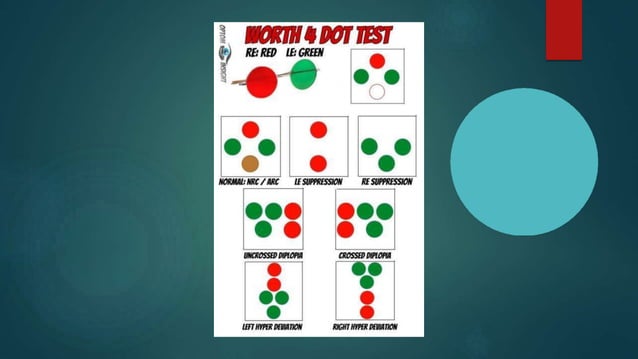 TESTS FOR GRADE OF BINOCULAR VISION AND SENSORY.pptx