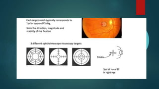 TESTS FOR GRADE OF BINOCULAR VISION AND SENSORY.pptx
