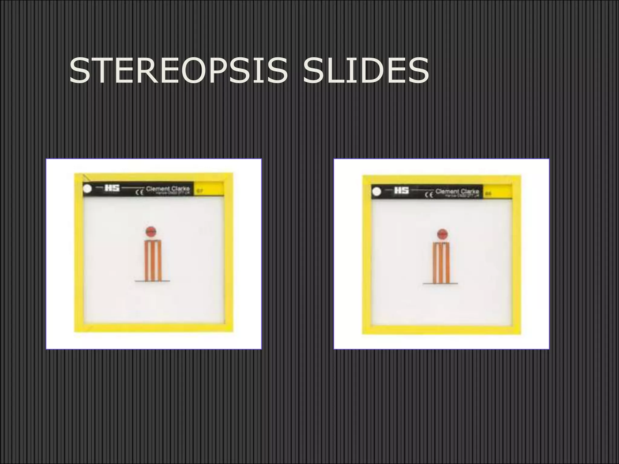 Tests for stereopsis | PPT