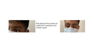 Tests in dry eye | PPTX