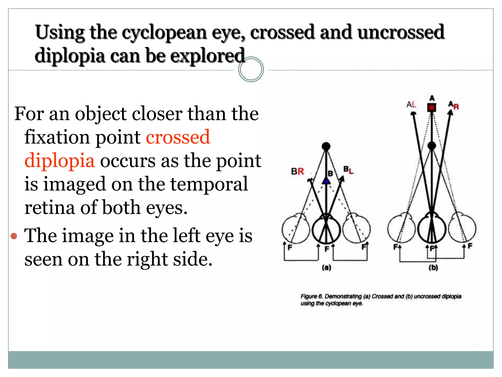 Tests of binocularity | PPTX
