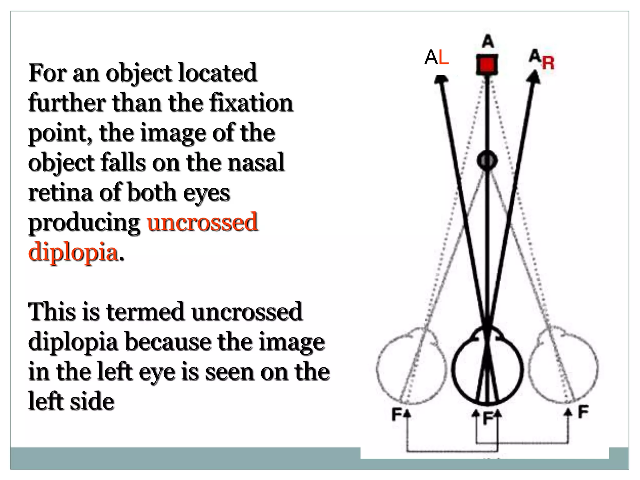 Tests of binocularity | PPTX