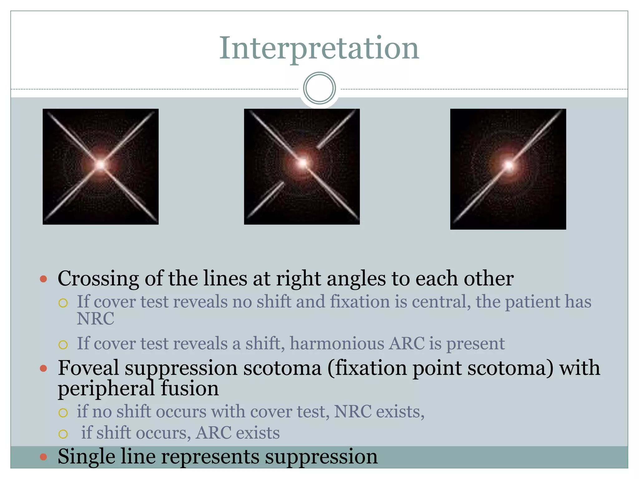 Tests of binocularity | PPTX