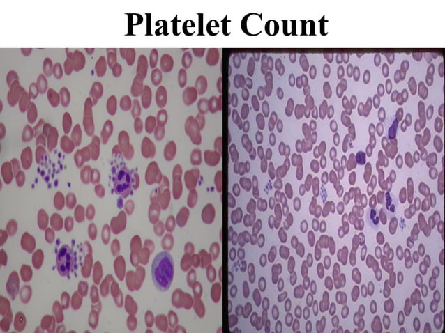 Tests of bleeding disorders | PPT