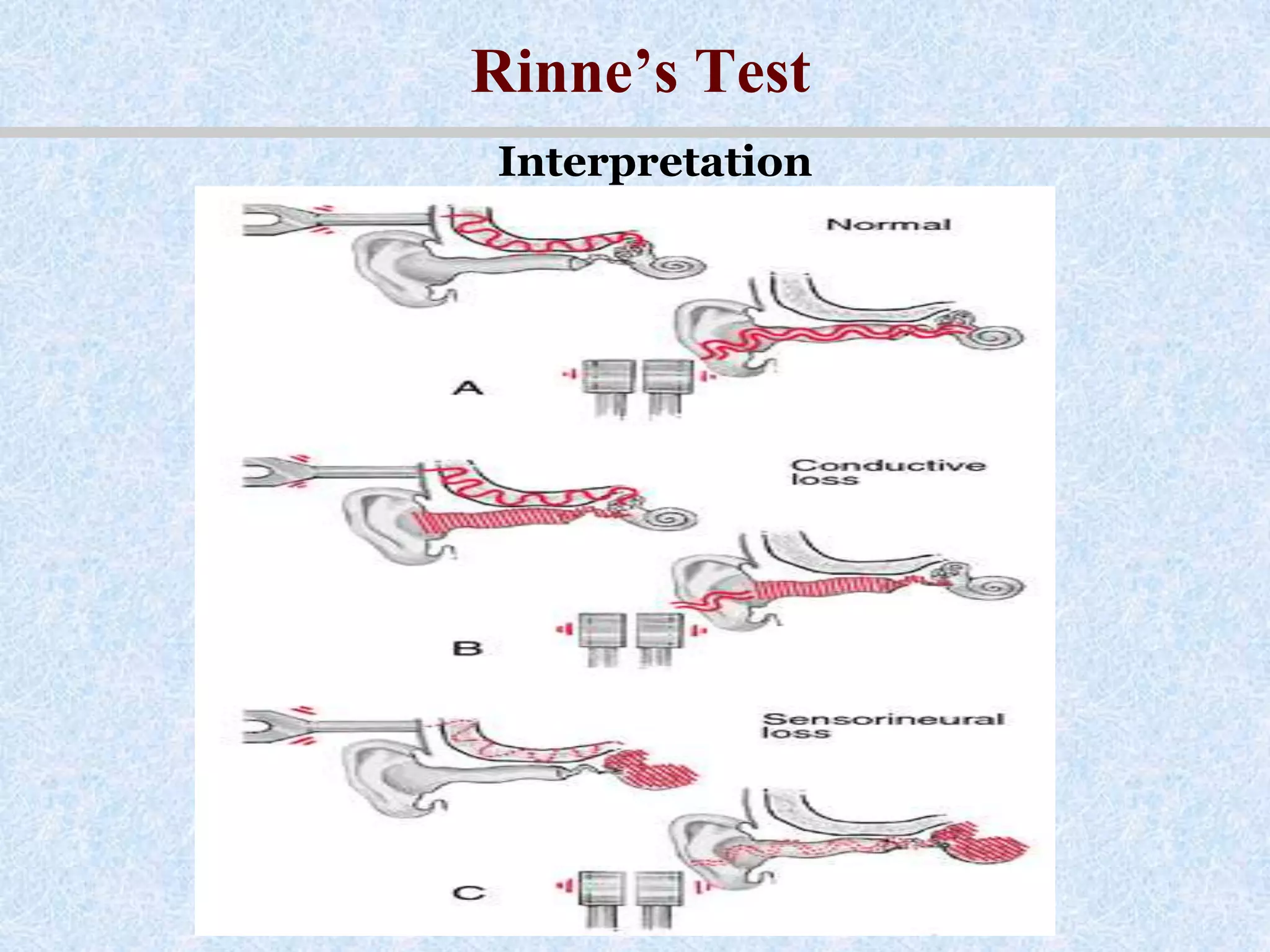 Tests of hearing | PPTX