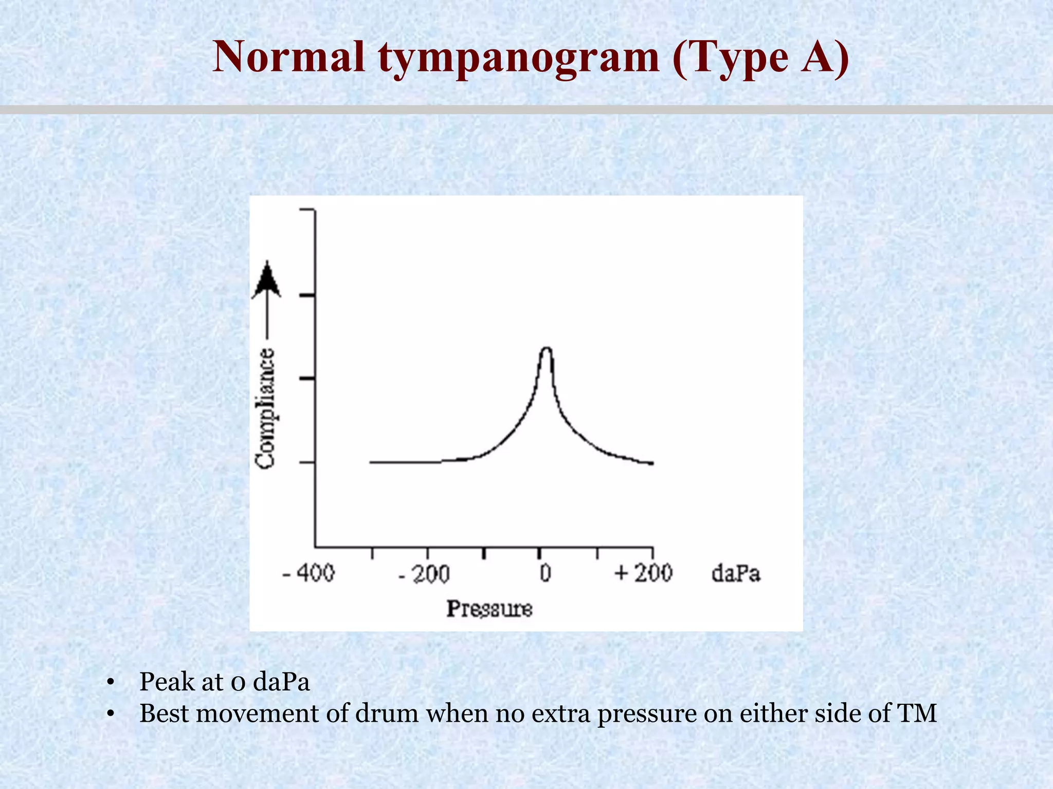 Tests of hearing | PPTX