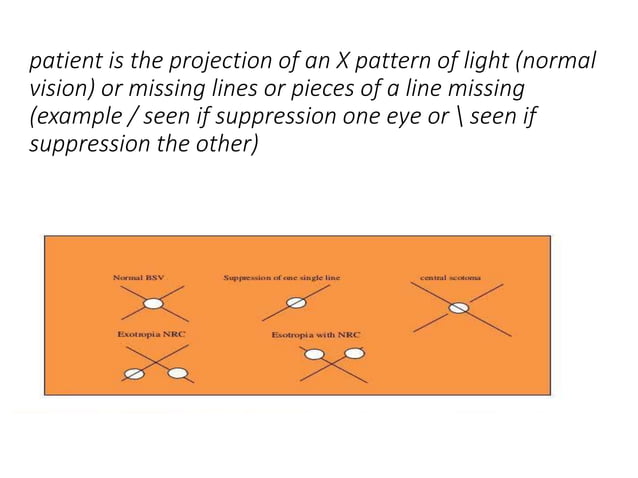 Tests of suppression | PPTX