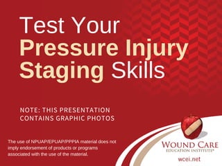 Test Your Pressure Injury Staging Skills - Updated for 2016 | PDF