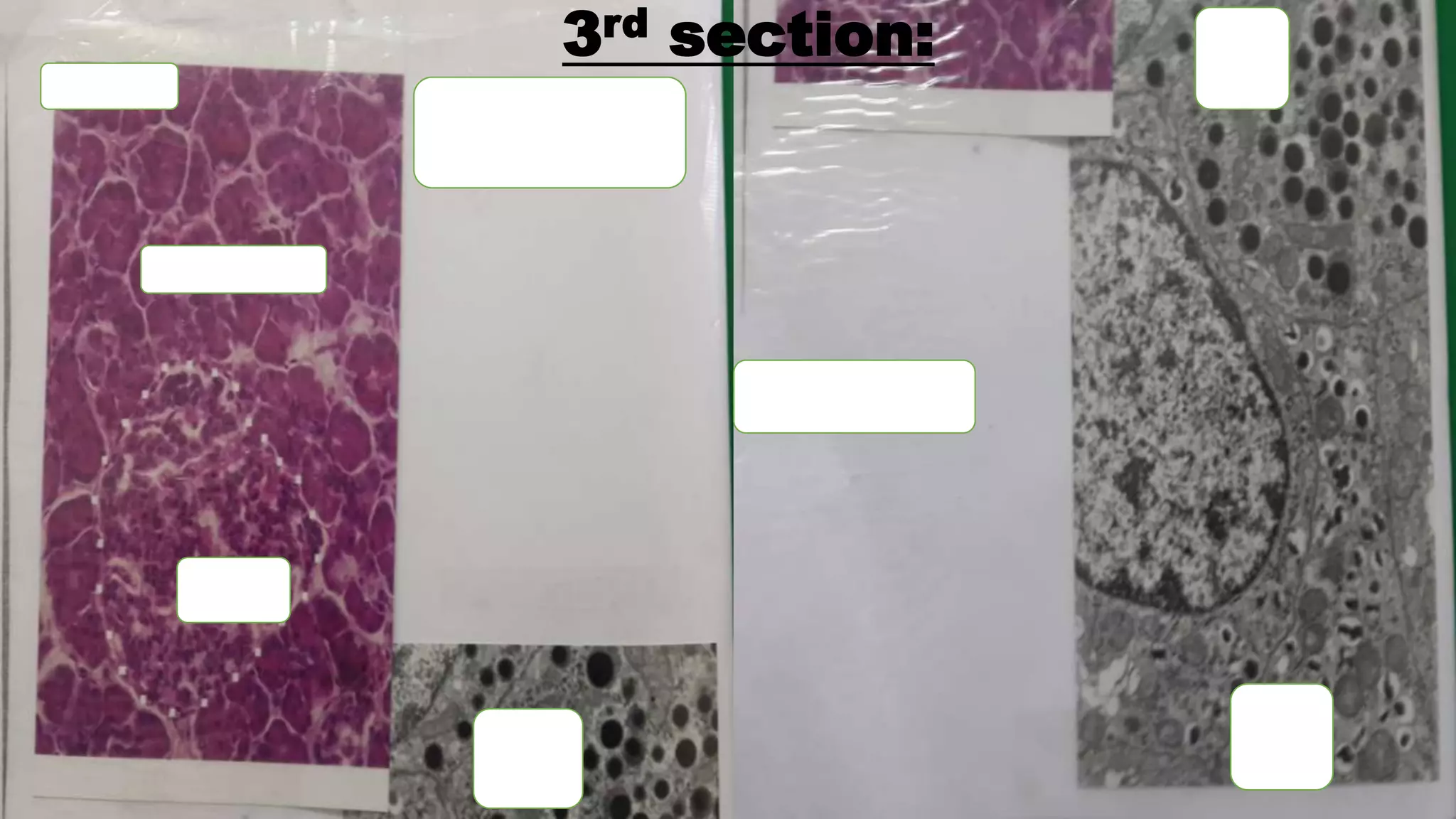 Test yourself PRACTICAL-ENDOCRINE histology | PPT