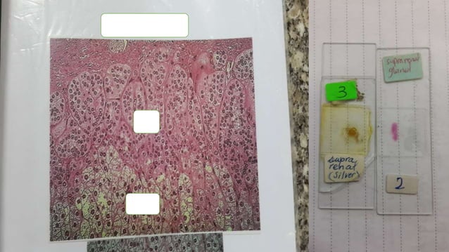 Test yourself PRACTICAL-ENDOCRINE histology | PPT