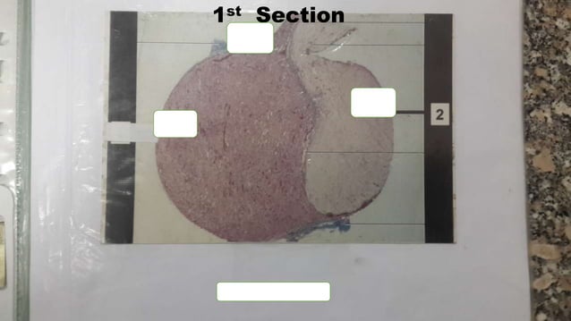 Test yourself PRACTICAL-ENDOCRINE histology | PPT