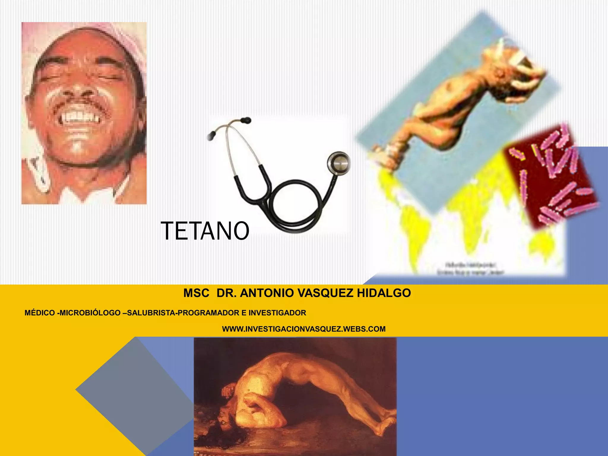 Tetano | PPT