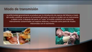 Tetano neonatal | PPTX