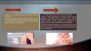 Tetano neonatal | PPTX
