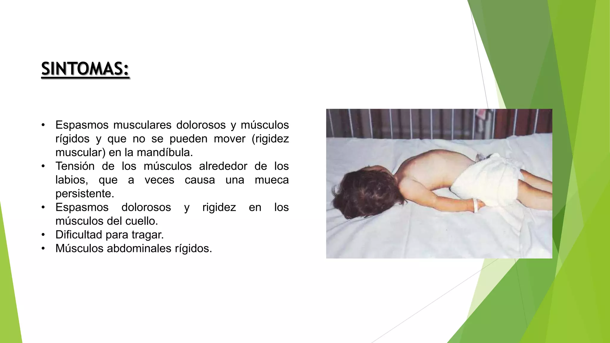 tetano neonatal. | PPTX