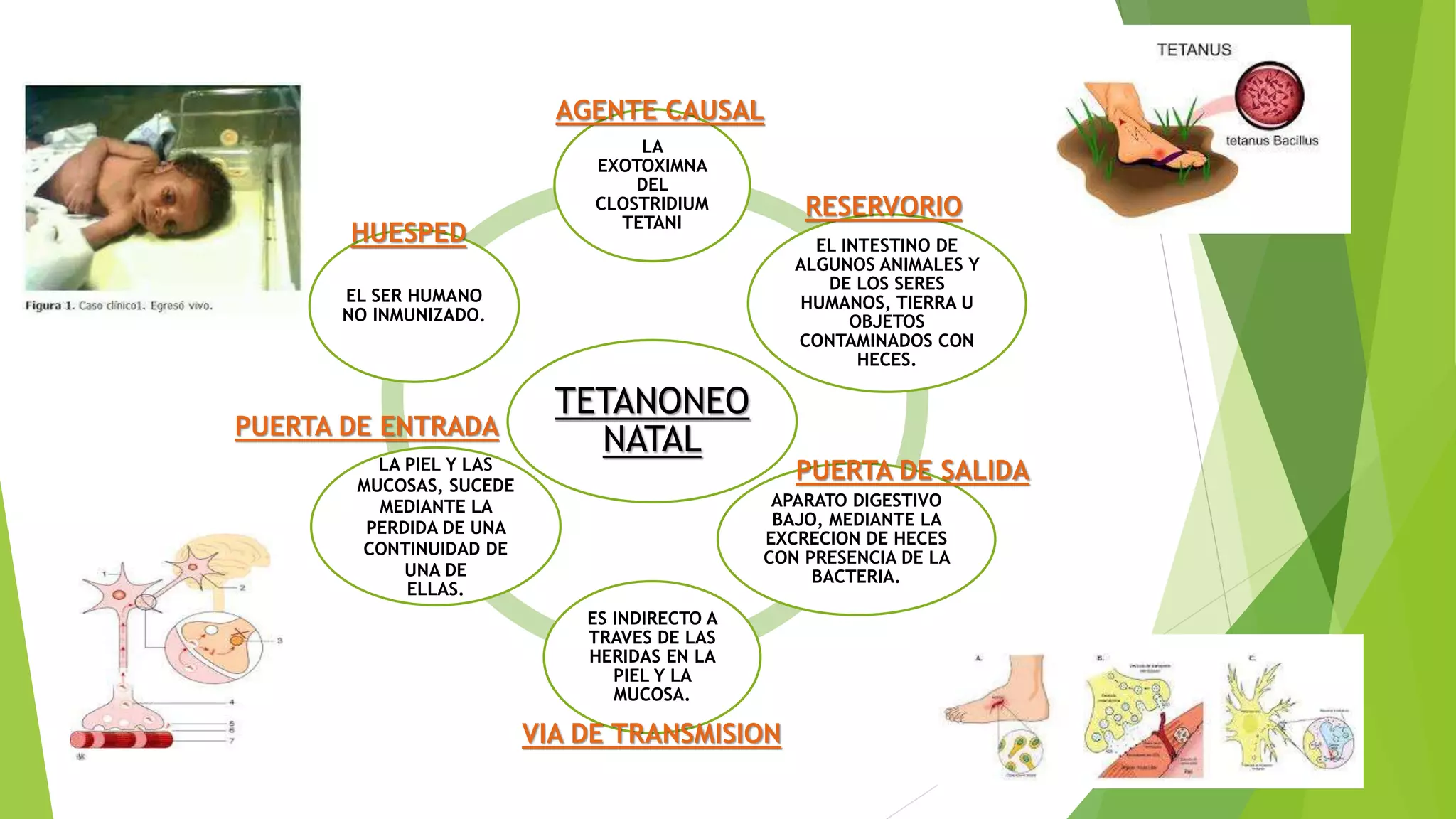 tetano neonatal. | PPTX