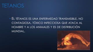 Tetanos | PPTX