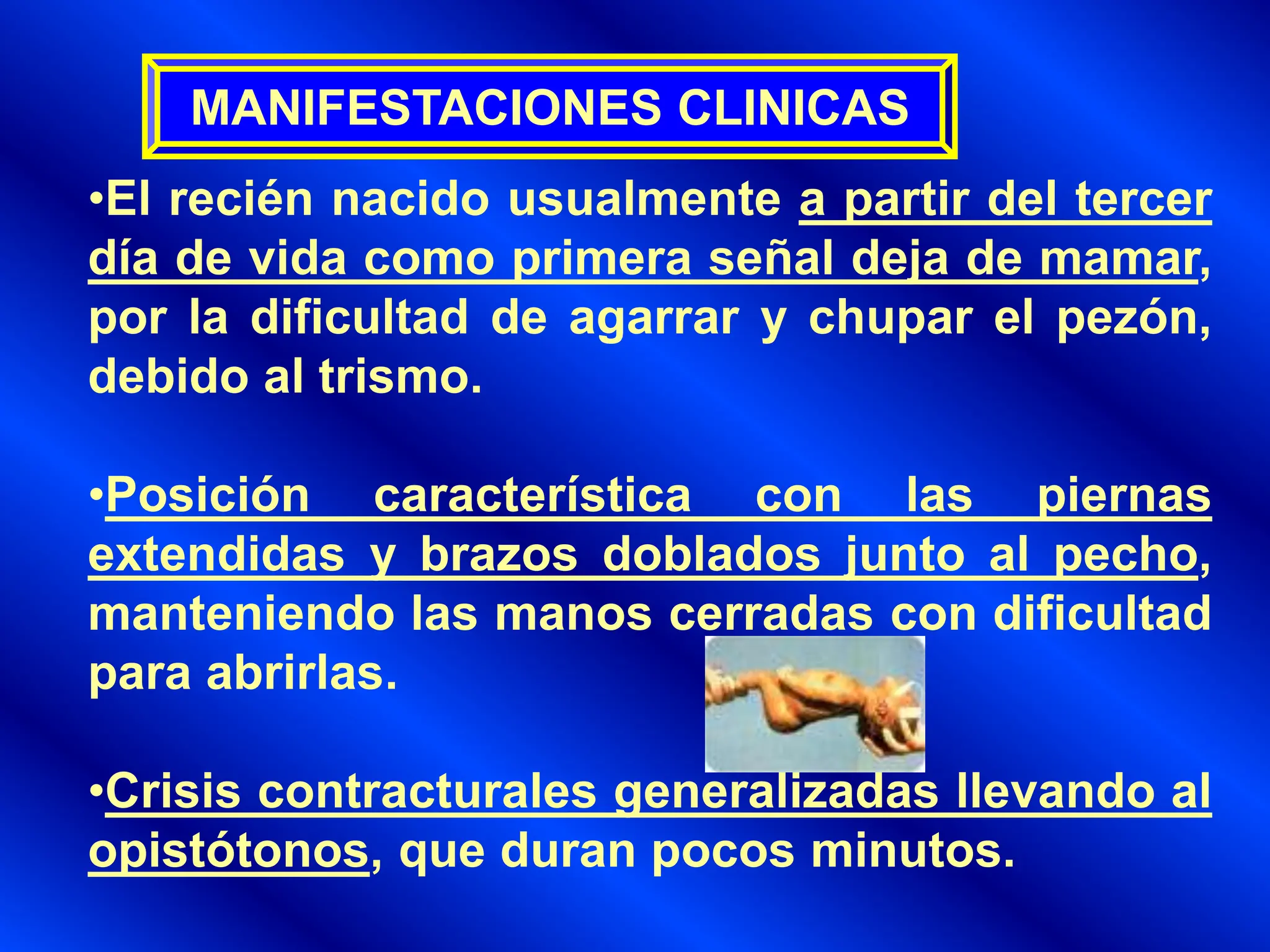 TETANOS El tétanos es una enfermedad grave del sistema nervioso causada ...