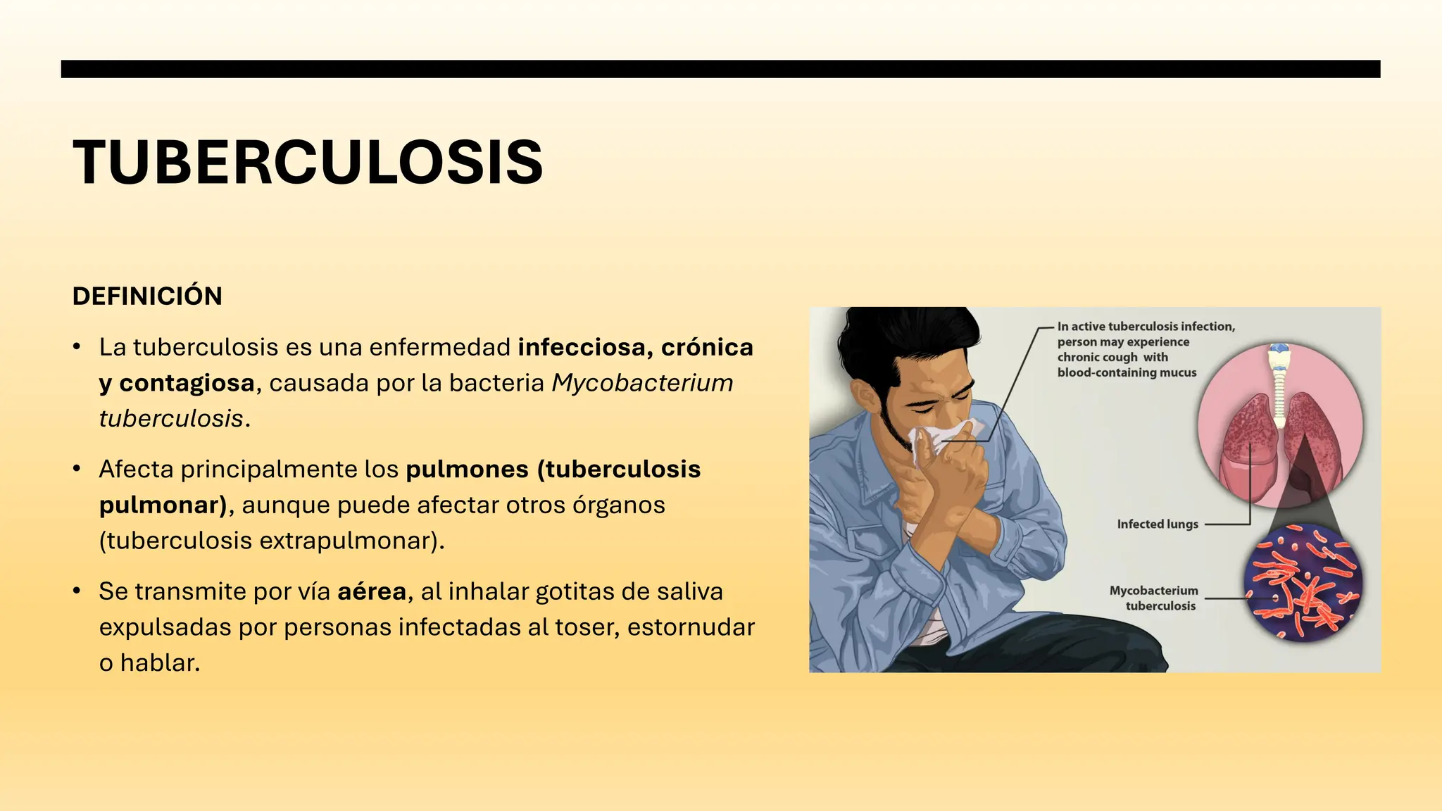 TETANOS y TUBERCULOSIS pediatria presentación | PDF