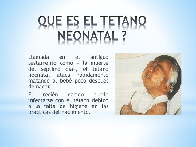 Tetano y tetano neonatal