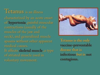 Tetanus | PPTX | Injuries | Diseases and Conditions