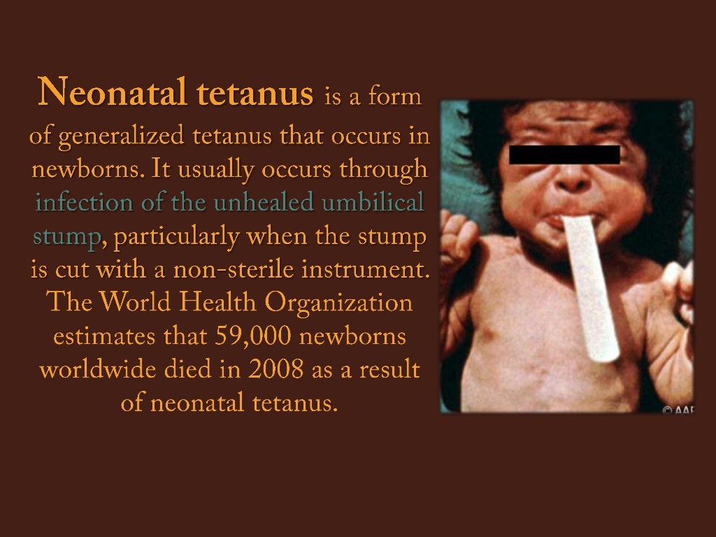 Tetanus