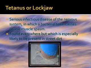 Tetanus | PPTX
