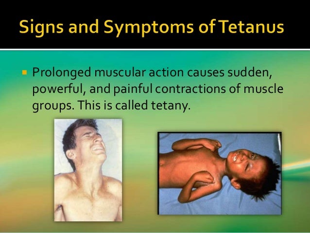Tetanus