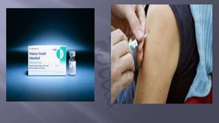Tetanus | PPTX