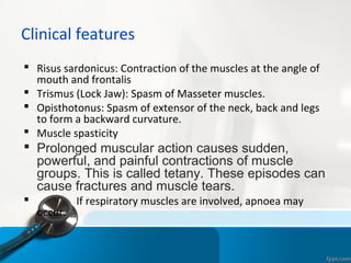 Tetanus by Dr.M.A.Aleem Siddiqui | PPT