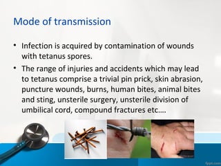 Tetanus by Dr.M.A.Aleem Siddiqui | PPT