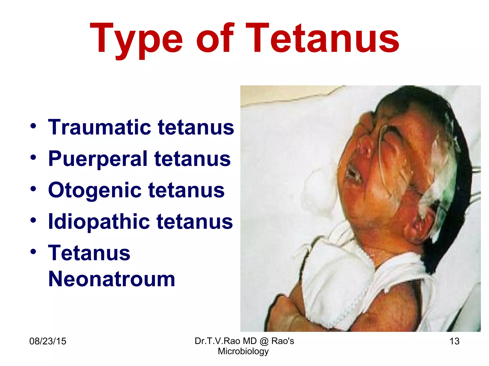 Tetanus Teaching basics | PPT