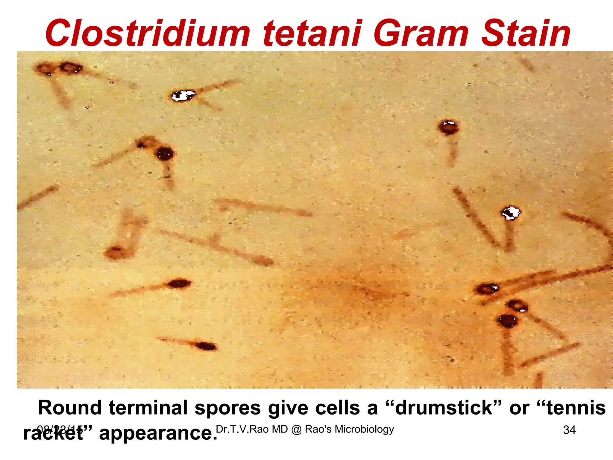 Tetanus Teaching basics | PPT