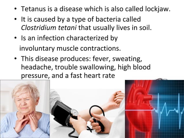 Tetanus | PPT