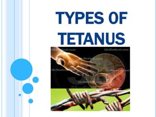 Tetanus | PPTX