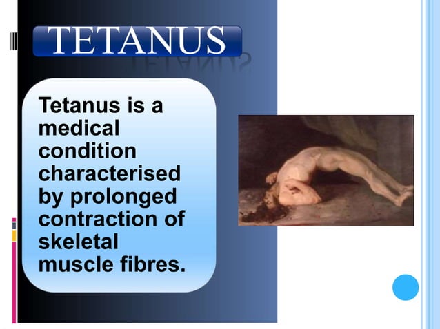 Tetanus | PPTX | Infectious Diseases | Diseases and Conditions