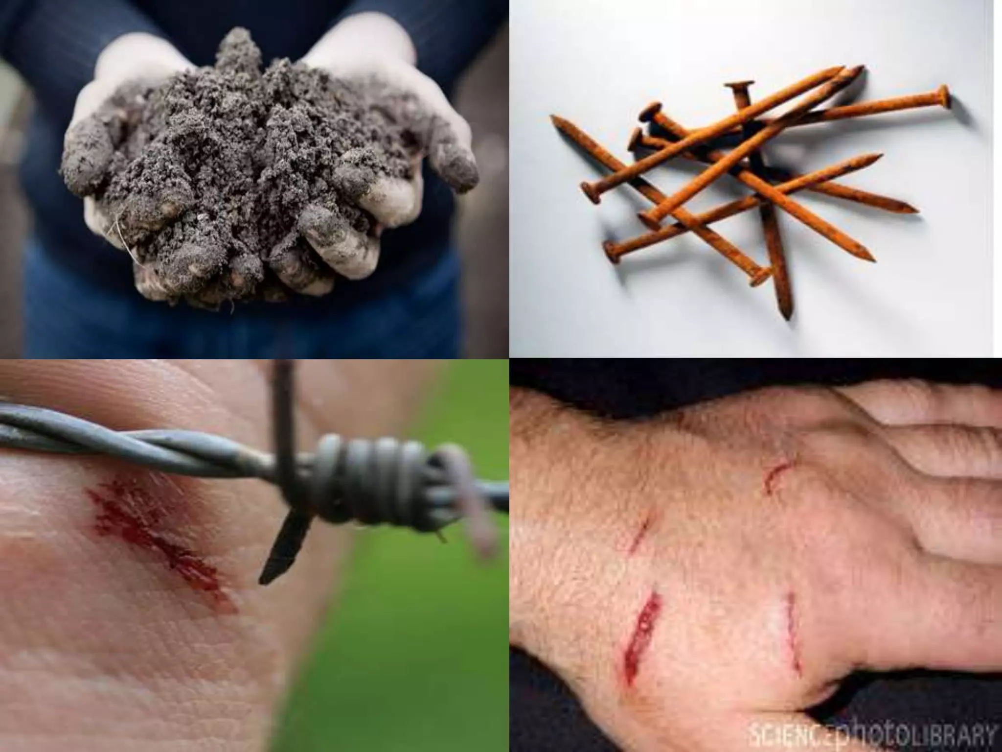 Tetanus | PPTX