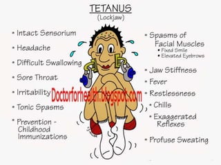 Tetanus Symptoms