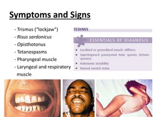 Tetanus | PPT