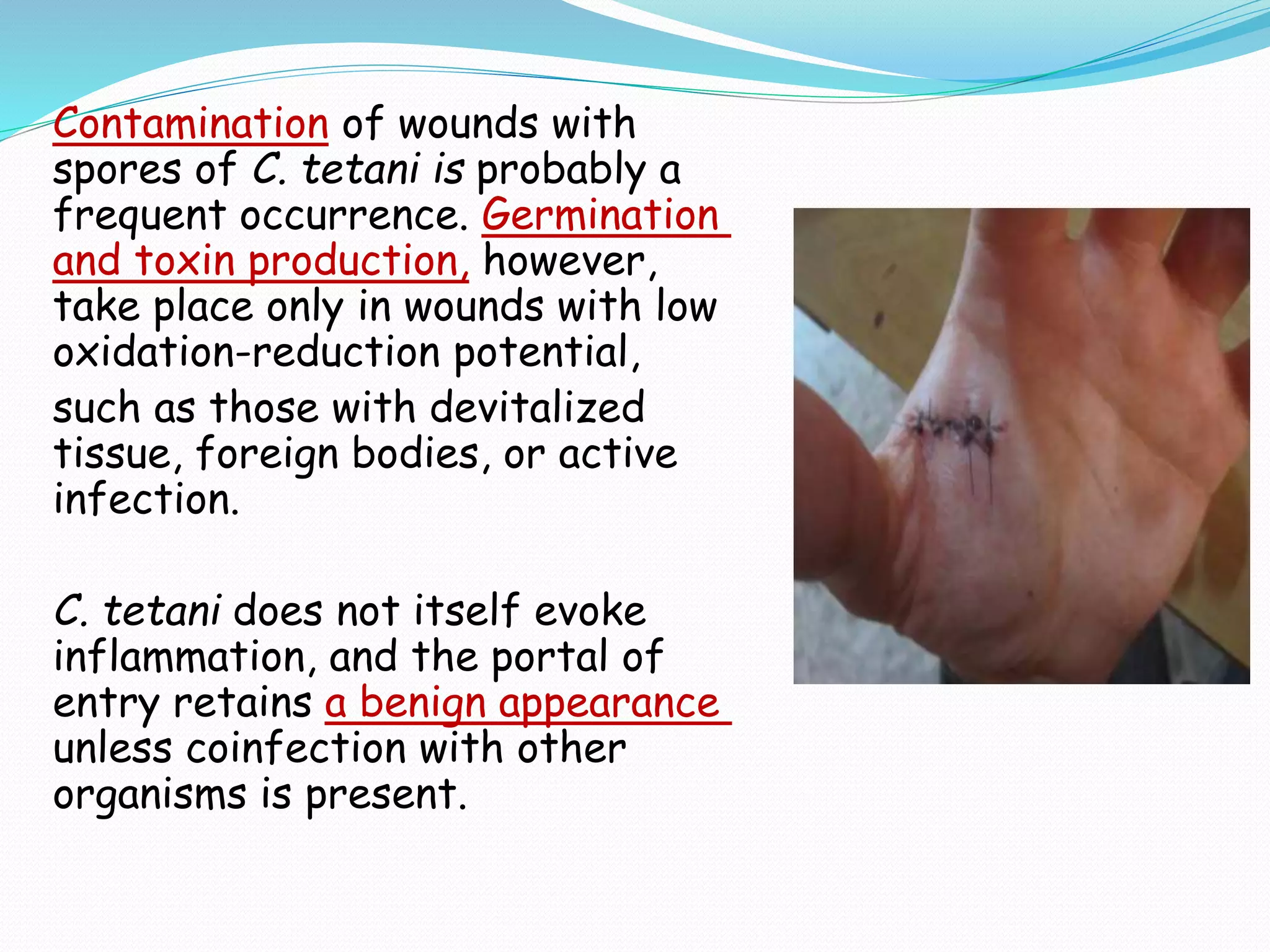 Tetanus Pptx