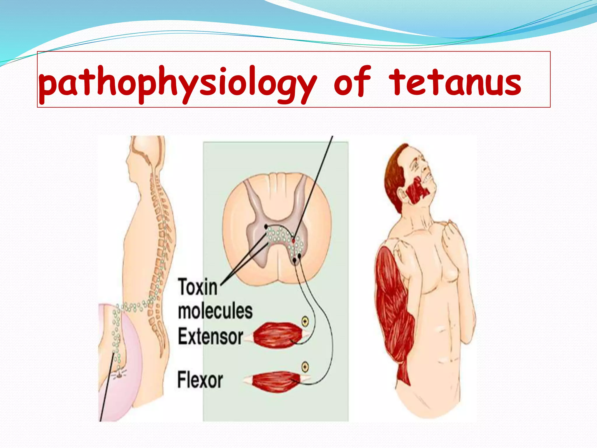 Tetanus | PPTX